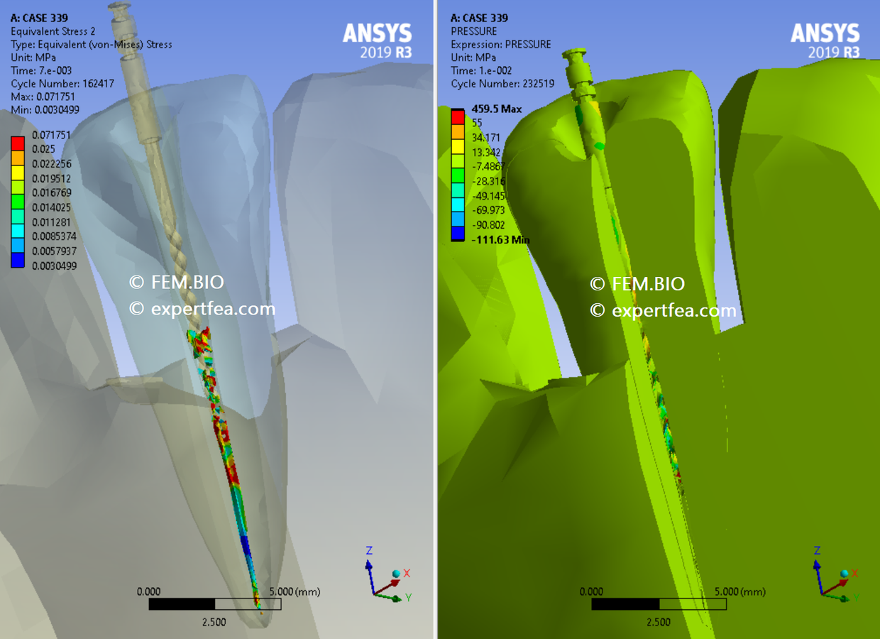 ANSYS Workbench 2019 R3 WBPZ archive and 3D model for - expertfea.com