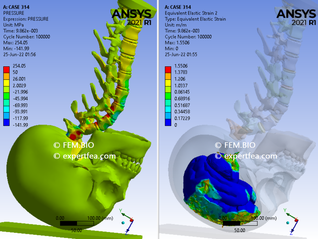 ANSYS Workbench 2021 R1 WBPZ archive + 3D model for Co - expertfea.com ...