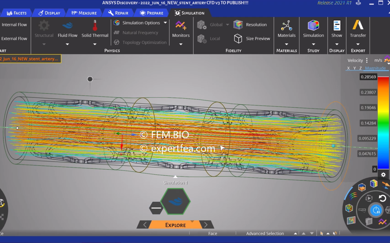 ANSYS DISCOVERY 2021 R1 solved file for Simple Hemodyn - expertfea.com ANSYS DISCOVERY 2021 R1 solved file for Simple Hemodyn - expertfea.com