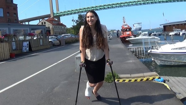 Julie 2 SLC - I try to walk tip toe on my cast but may - Swecrutch